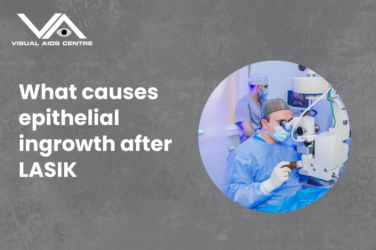 What Causes Epithelial Ingrowth After LASIK?