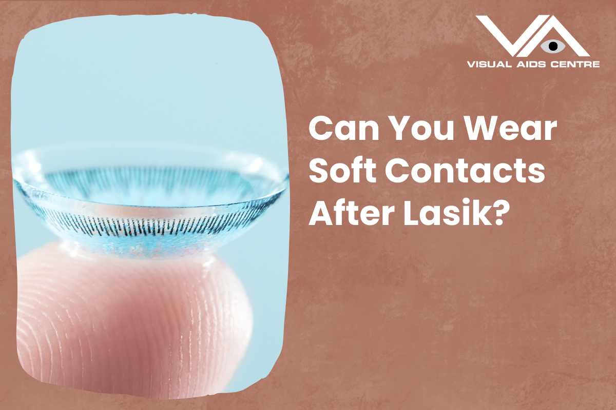 Can You Wear Soft Contacts After Lasik?