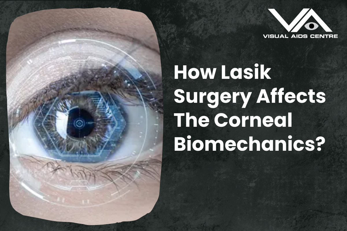 How Lasik Surgery Affects The Corneal Biomechanics?