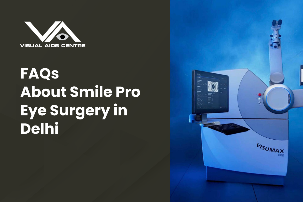 FAQs About Smile Pro Eye Surgery in Delhi