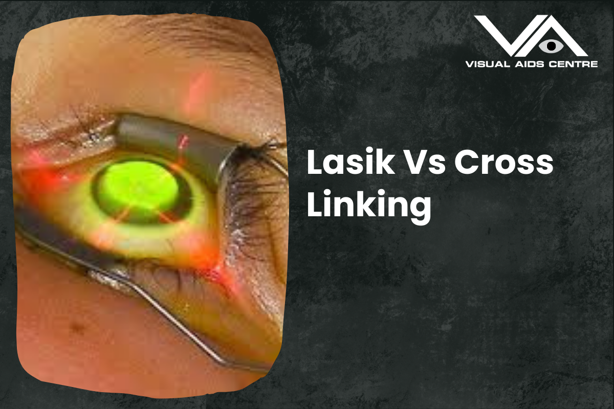 Lasik Vs Cross Linking?