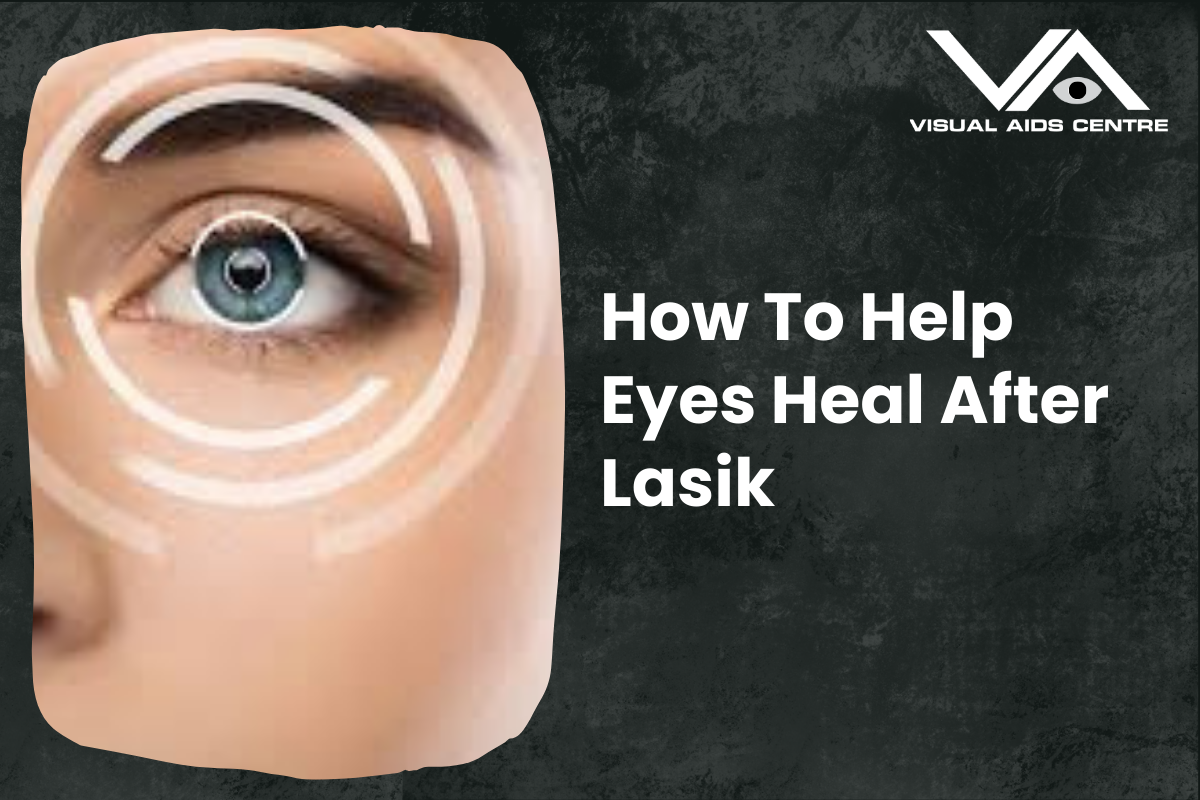 How To Help Eyes Heal After Lasik?