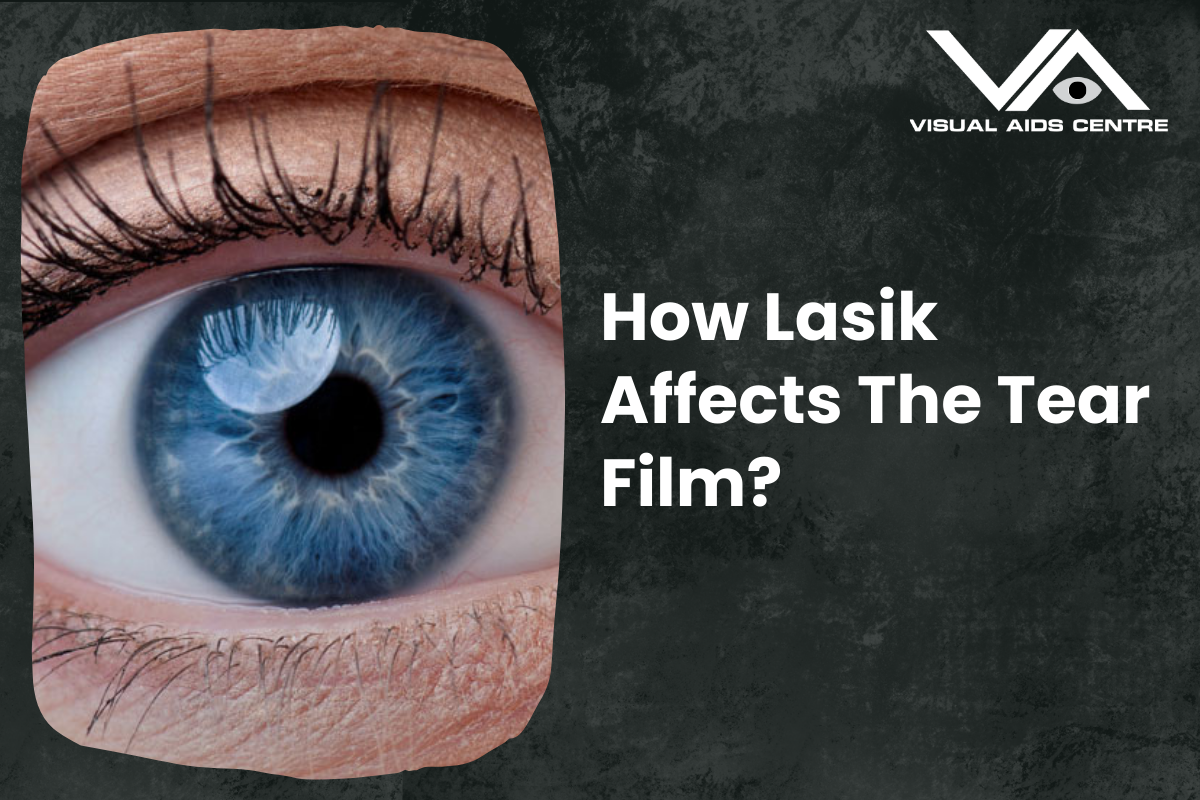 How Lasik Affects The Tear Film?