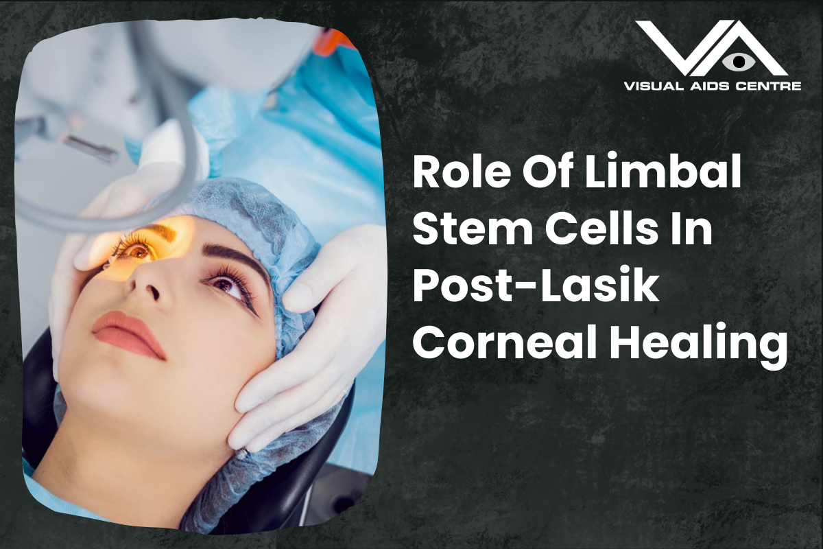 Role Of Limbal Stem Cells In Post-Lasik Corneal Healing?