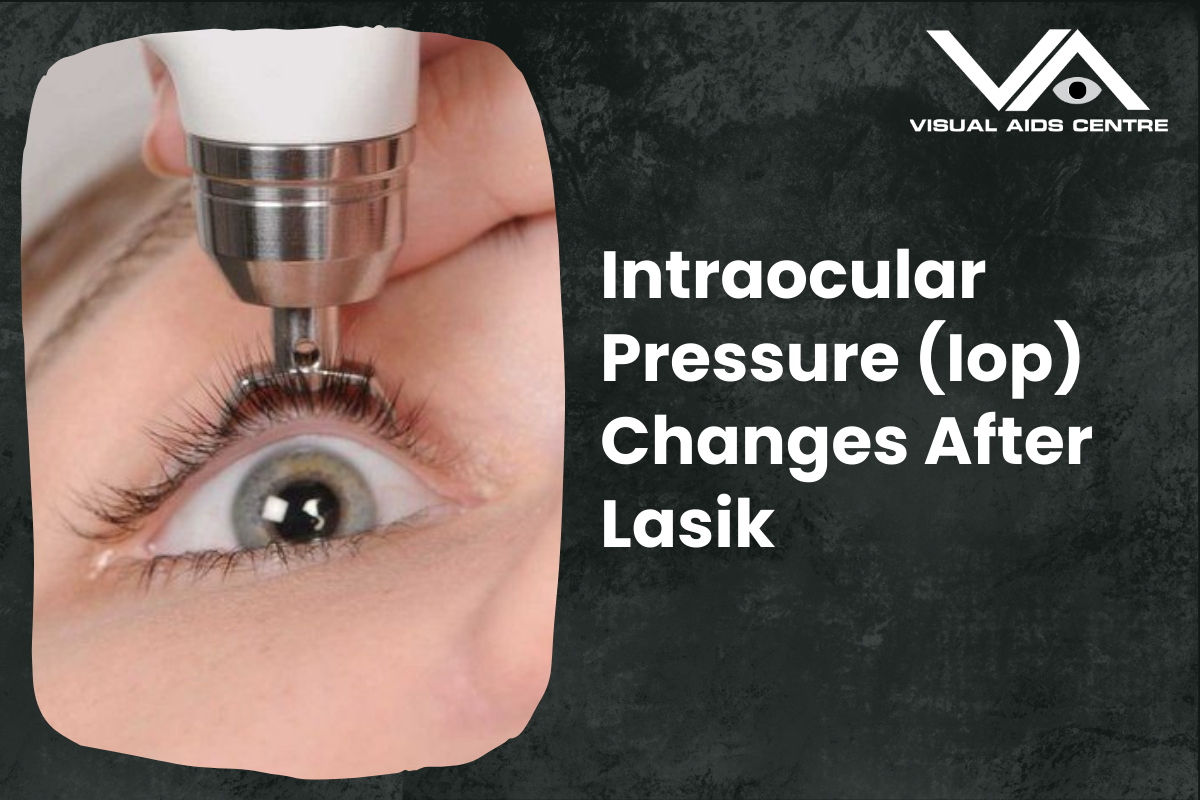 Intraocular Pressure (Iop) Changes After Lasik?