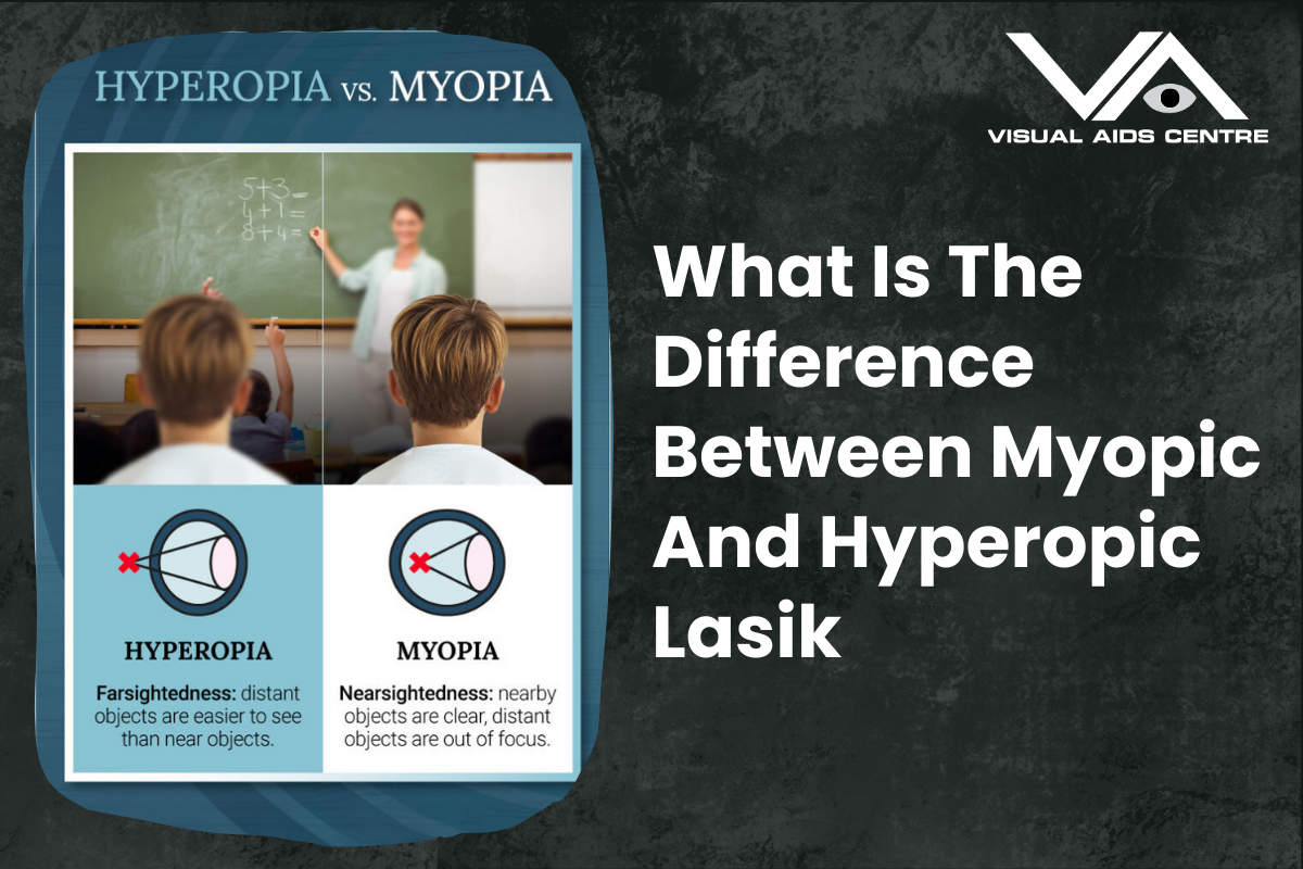 What Is The Difference Between Myopic And Hyperopic Lasik?