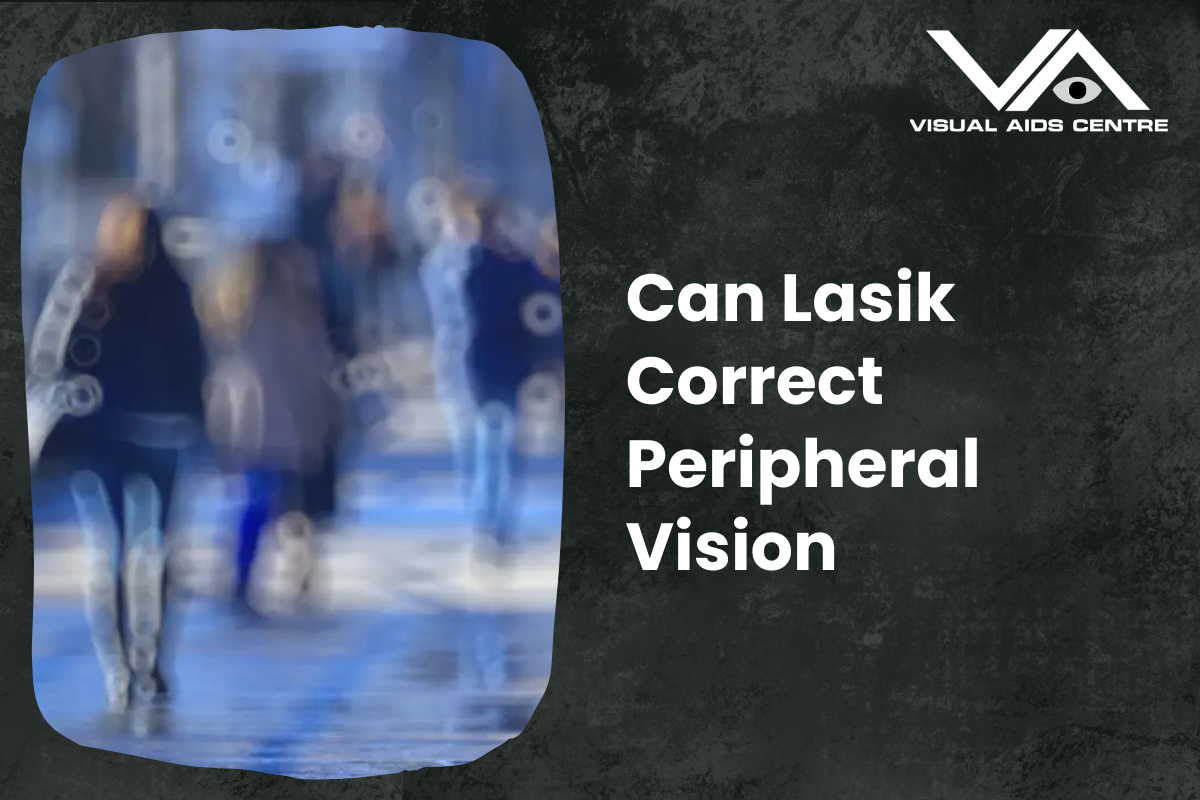 Can Lasik Correct Peripheral Vision