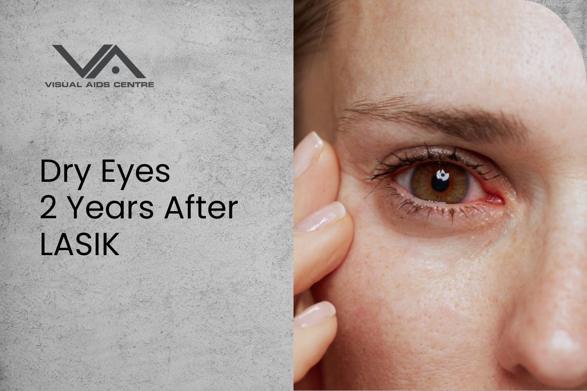 Dry Eyes 2 Years After Lasik: What to Expect