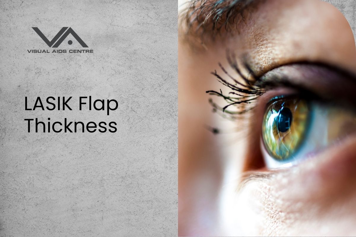 Optimal Lasik Flap Thickness for Improved Outcomes