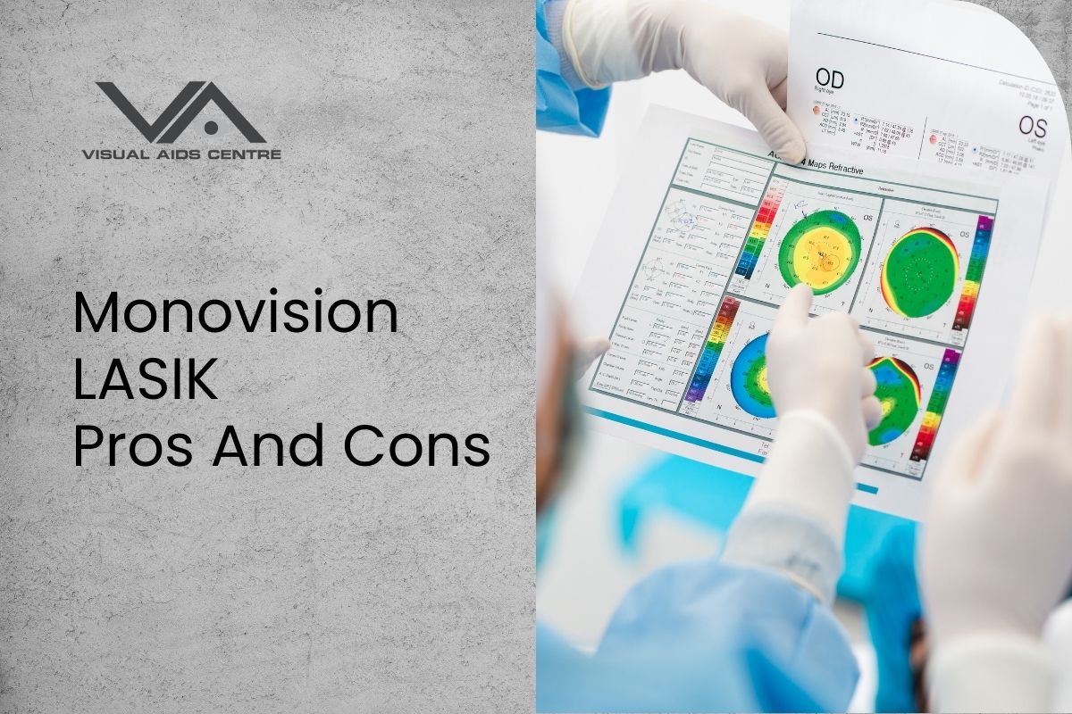 Discover the Pros and Cons of Monovision Lasik