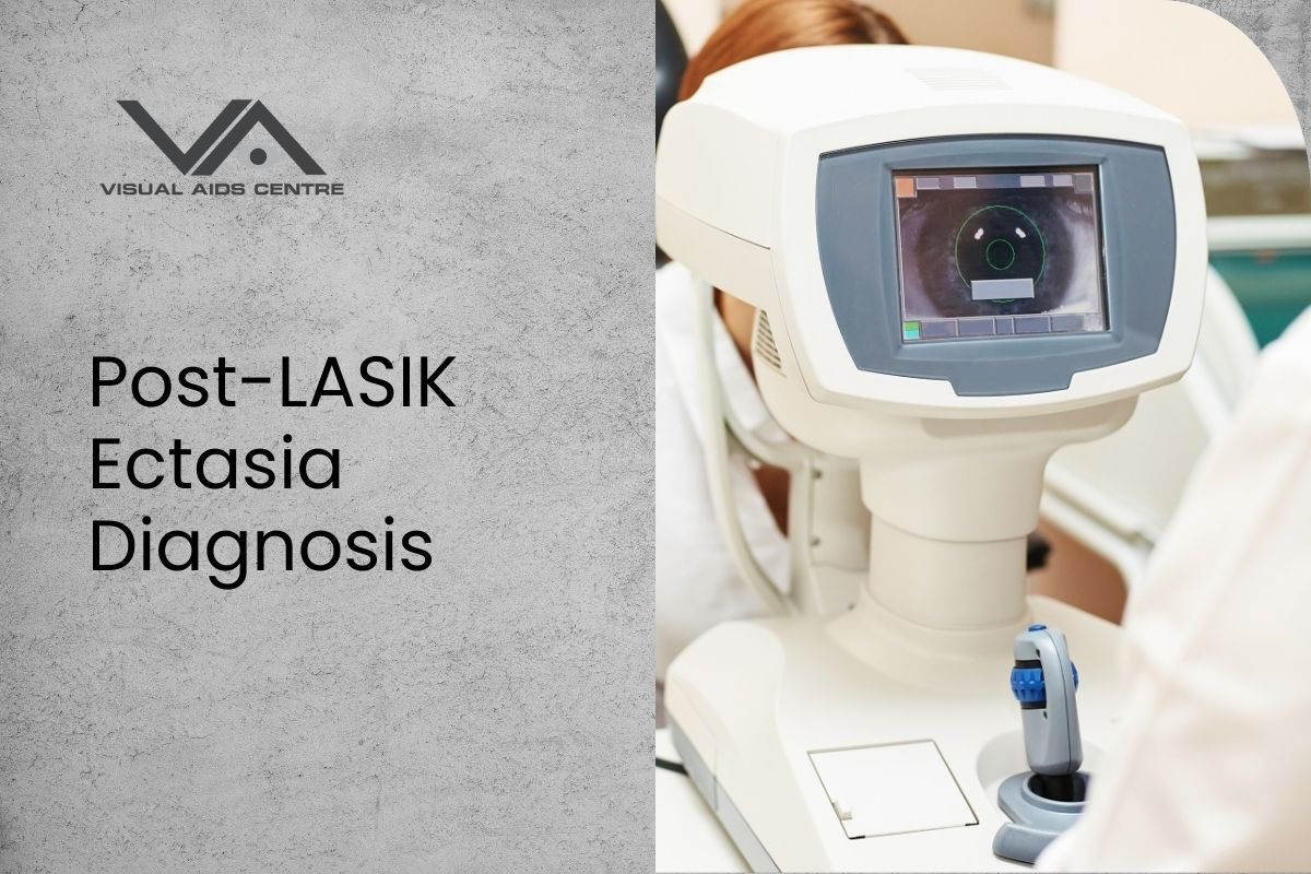 Post Lasik Ectasia Diagnosis - Visual Aids Centre