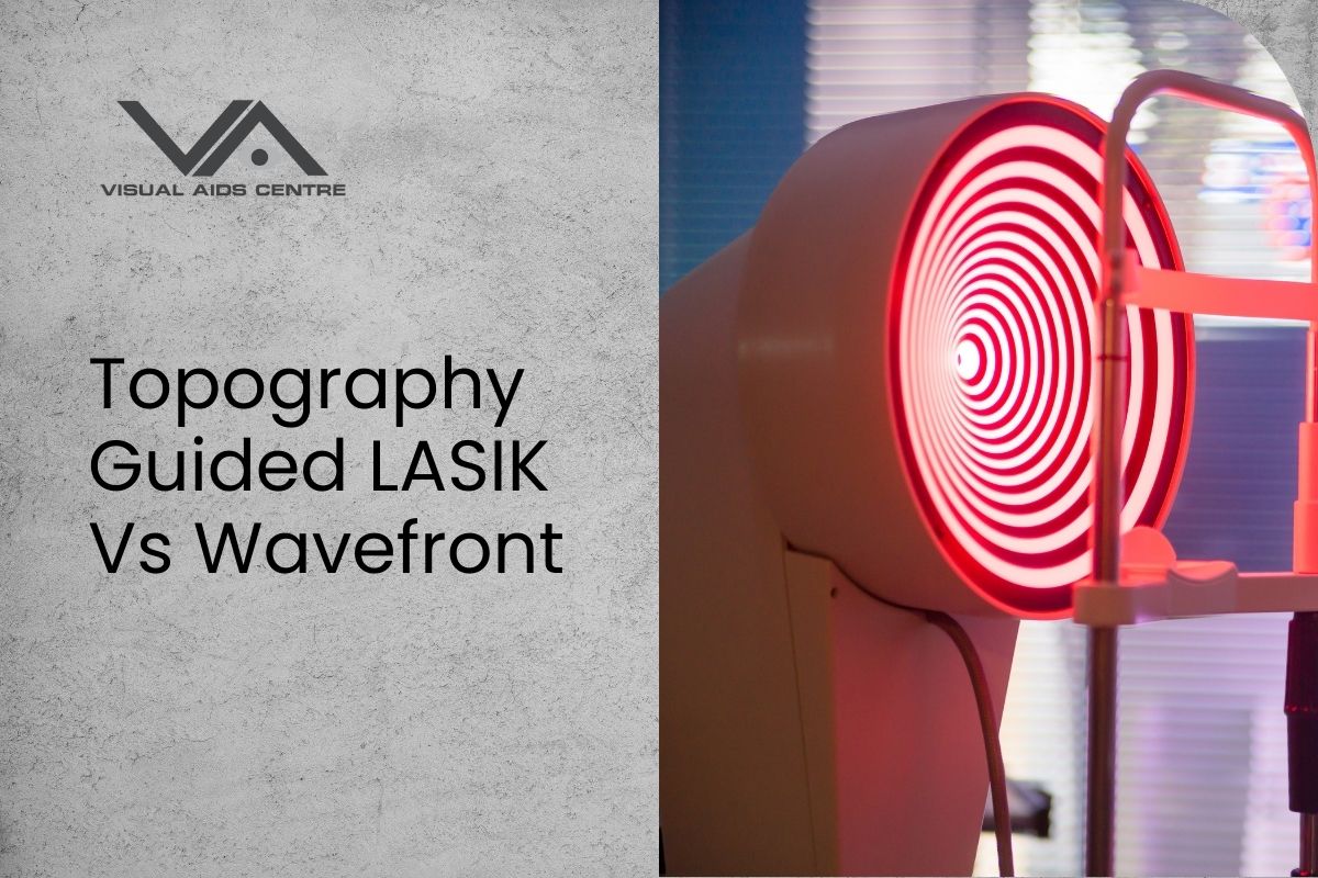 Topography Guided Lasik Vs Wavefront - Visual Aids Centre - Lasik Eye ...