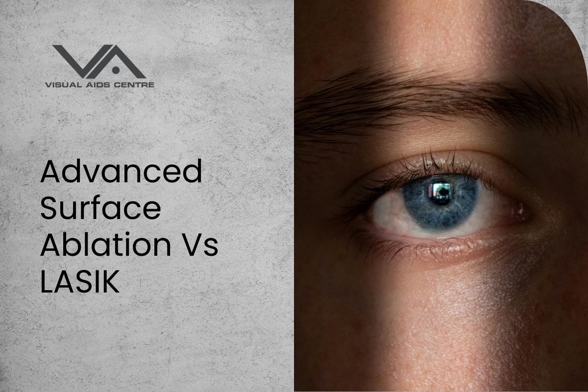 Advanced Surface Ablation Vs Lasik - Visual Aids Centre - Lasik Eye ...