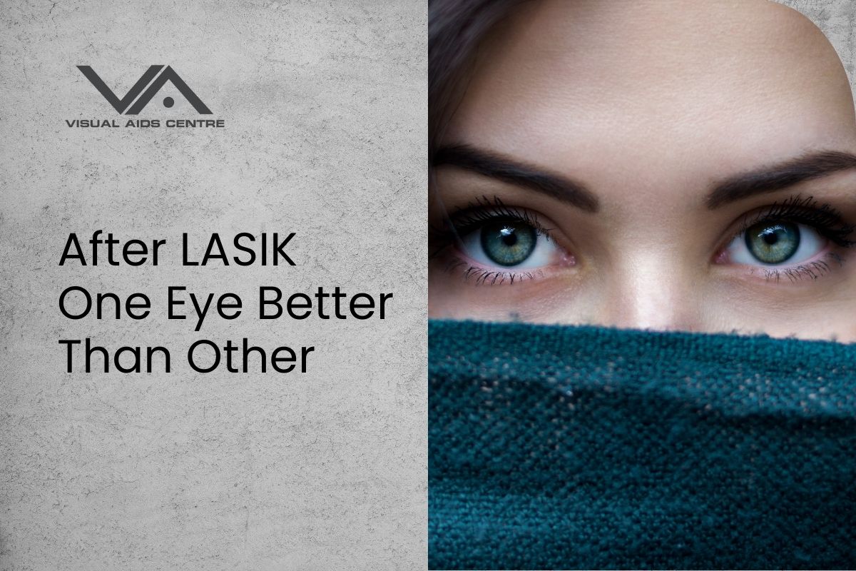 After Lasik One Eye Better Than Other - Visual Aids Centre
