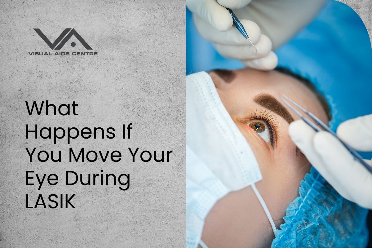 What Happens If You Move Your Eye During Lasik - Visual Aids Centre ...