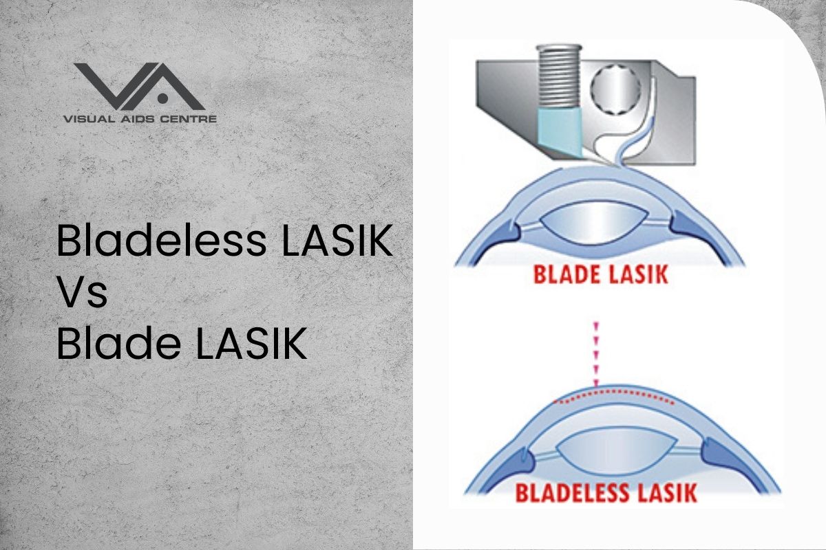 Bladeless Lasik vs Blade Lasik: Pros and Cons Explored - Visual Aids Centre