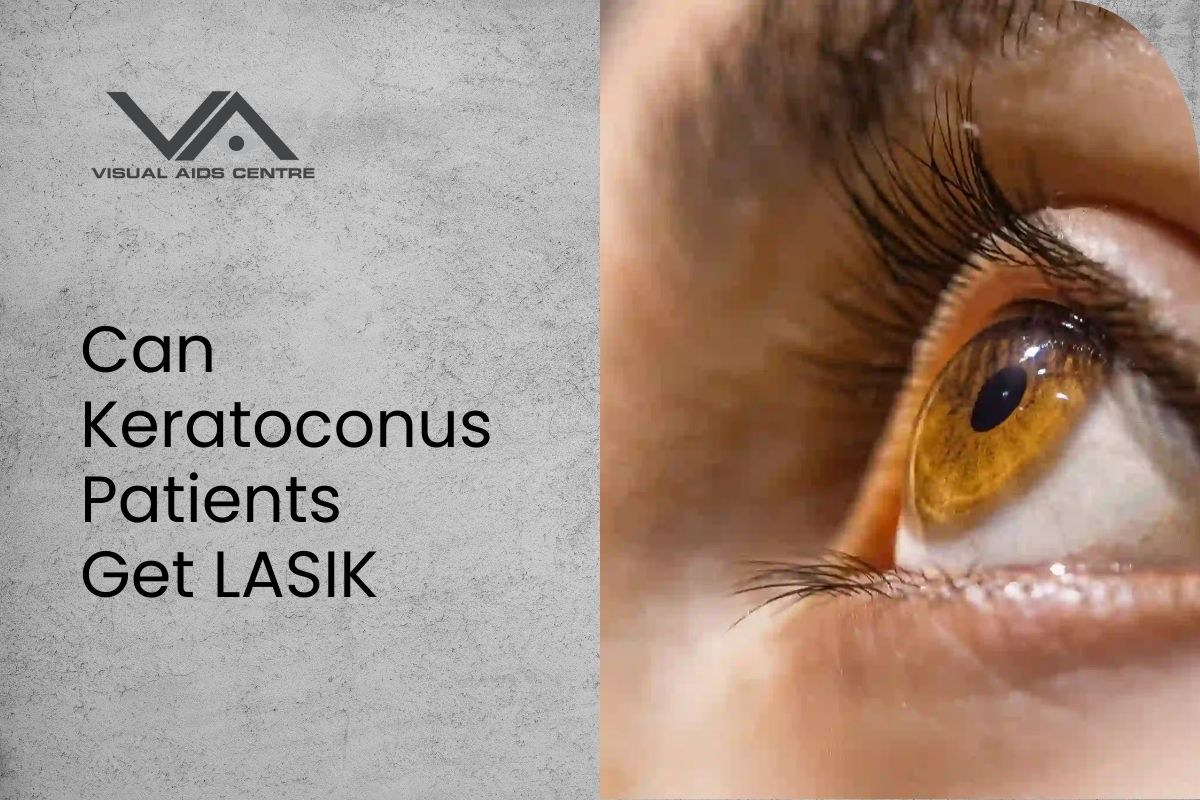 Can Keratoconus Patients Get Lasik - Visual Aids Centre - Lasik Eye ...