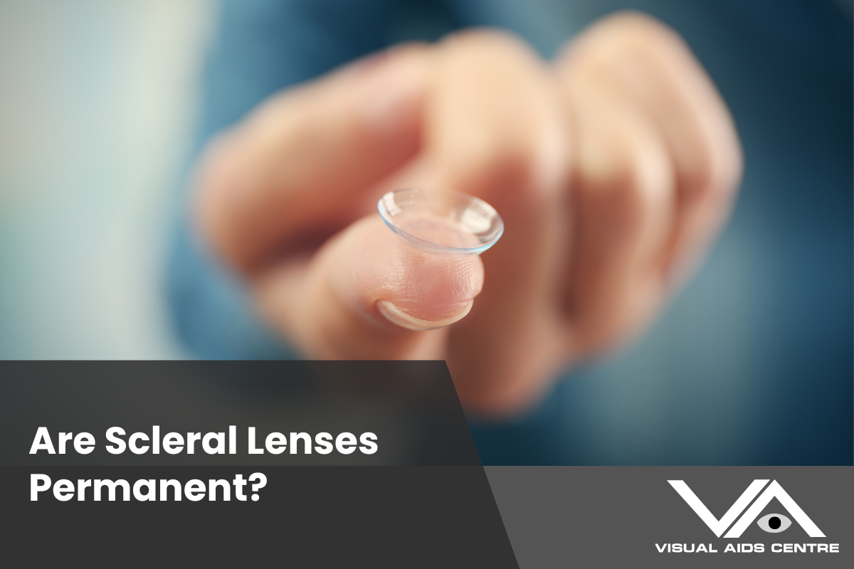 Are Scleral Lenses Permanent? What You Need to Know