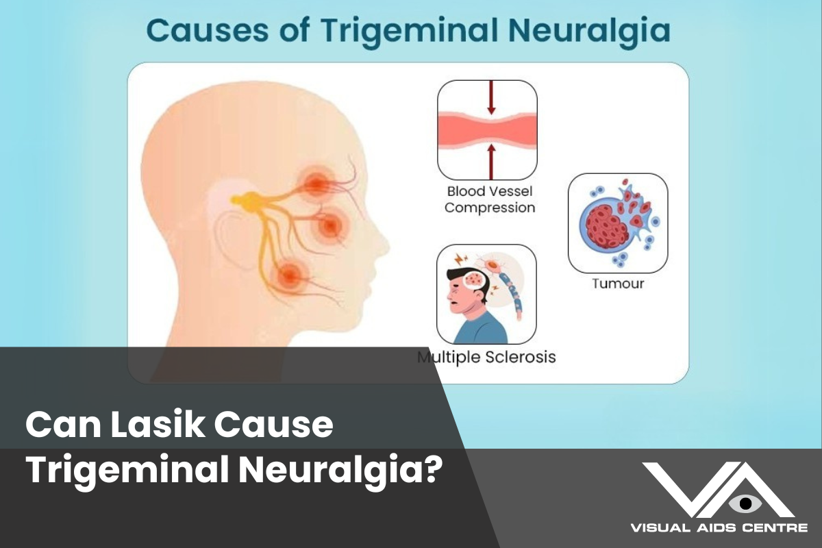 Can LASIK Cause Trigeminal Neuralgia? Exploring the Connection