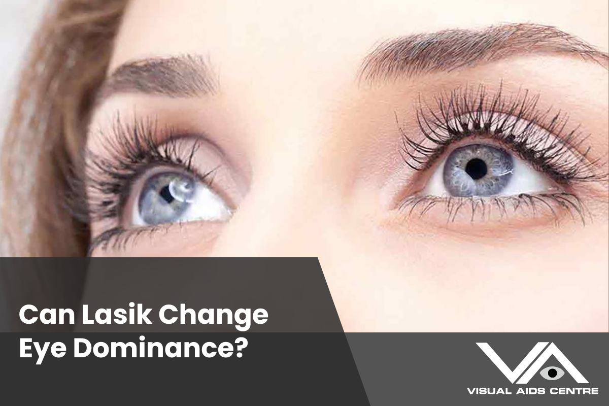Can LASIK Change Eye Dominance? What You Should Know