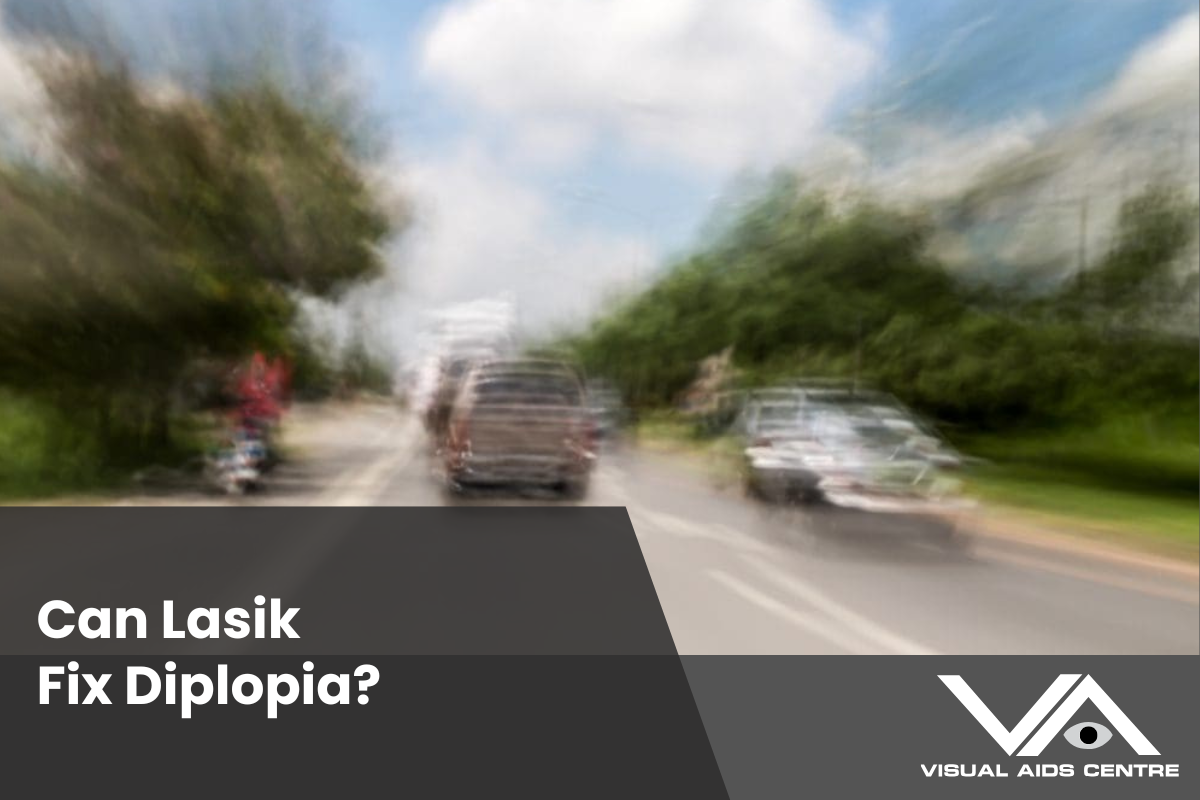 Can LASIK Fix Diplopia? Treatment Options and Considerations
