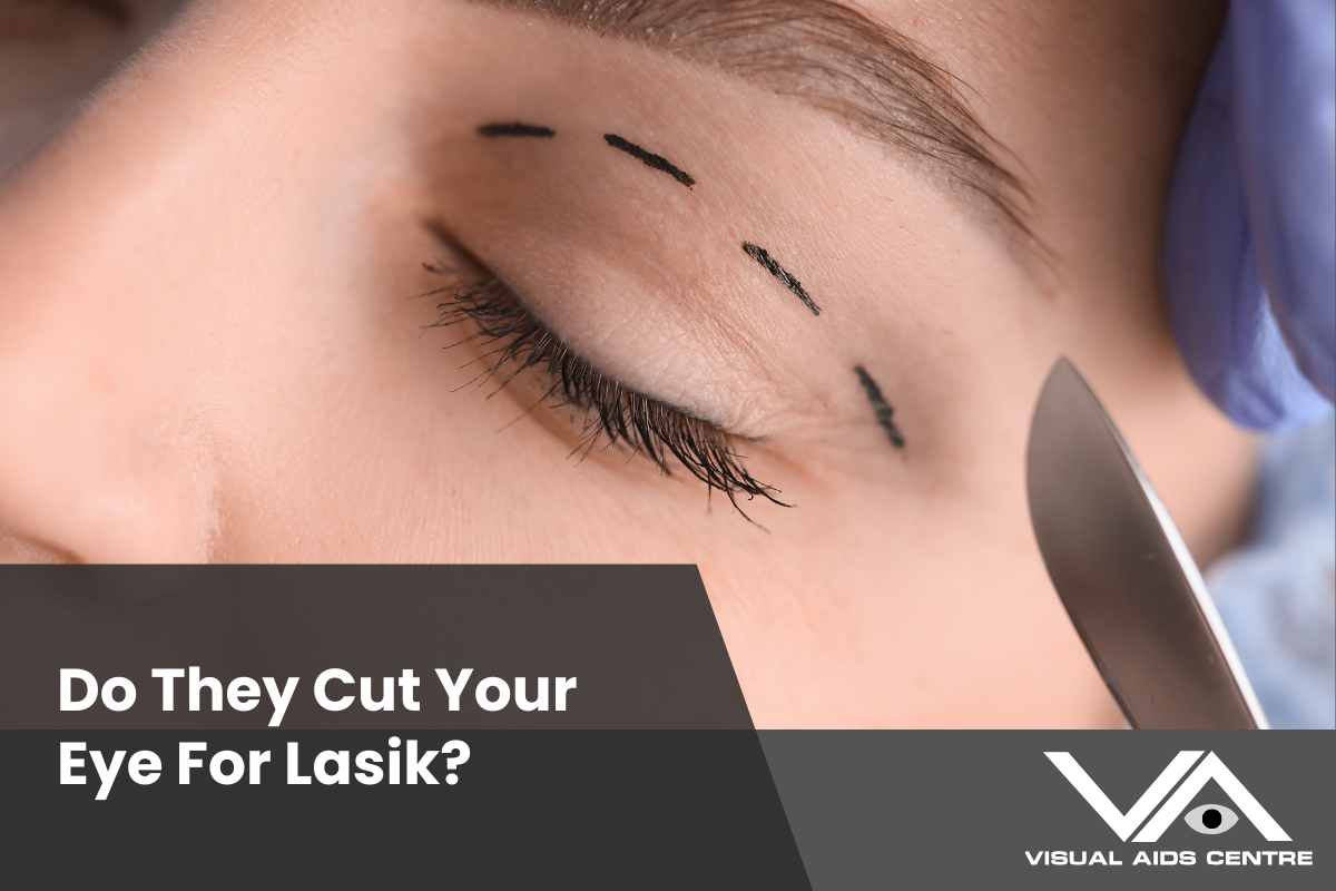 Do They Cut Your Eye for LASIK? What Happens During Procedure