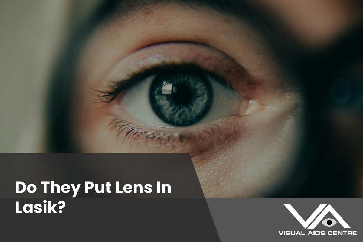 Do They Put a Lens in LASIK? Understanding LASIK Procedure