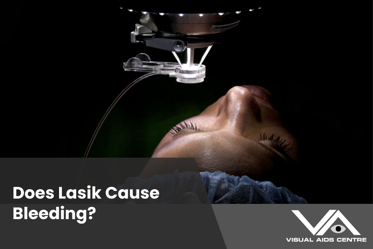 Does LASIK Cause Bleeding? Understanding the Risks