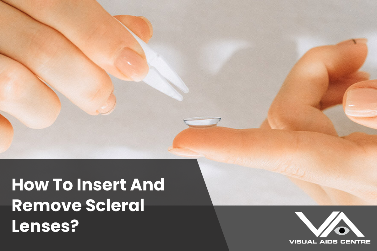 How to Insert and Remove Scleral Lenses: A Step-by-Step Guide