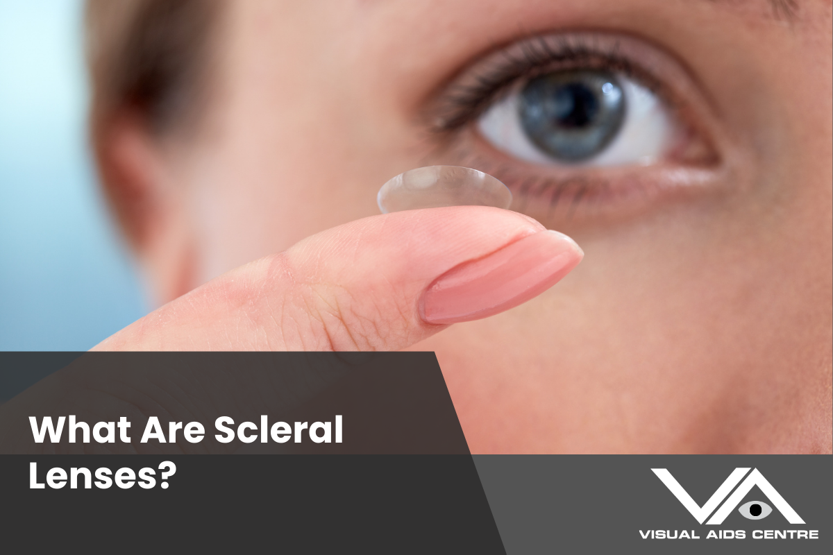 What Are Scleral Lenses? Benefits and Uses Explained