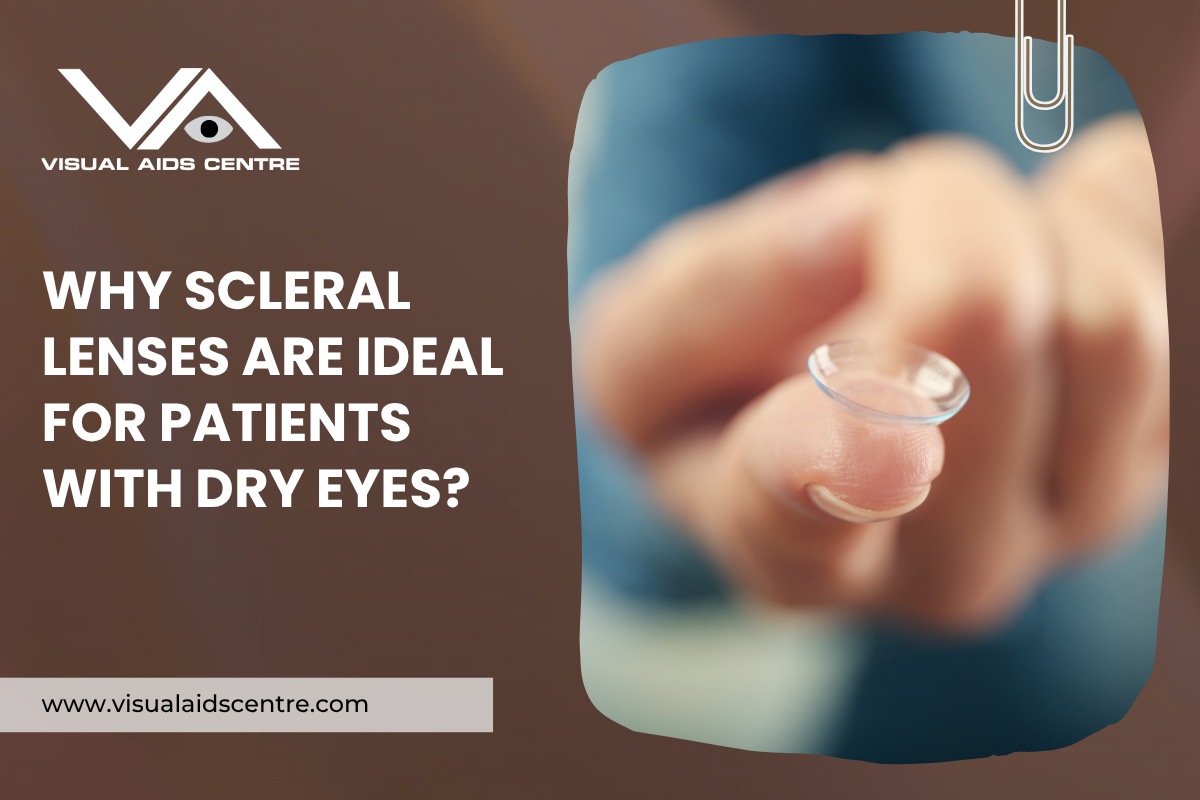 Why Scleral Lenses Are Ideal for Patients with Dry Eyes?