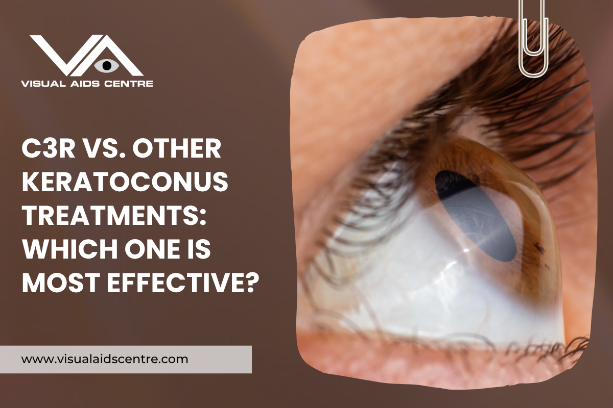 C3R vs. Other Keratoconus Treatments: Which One Is Most Effective?
