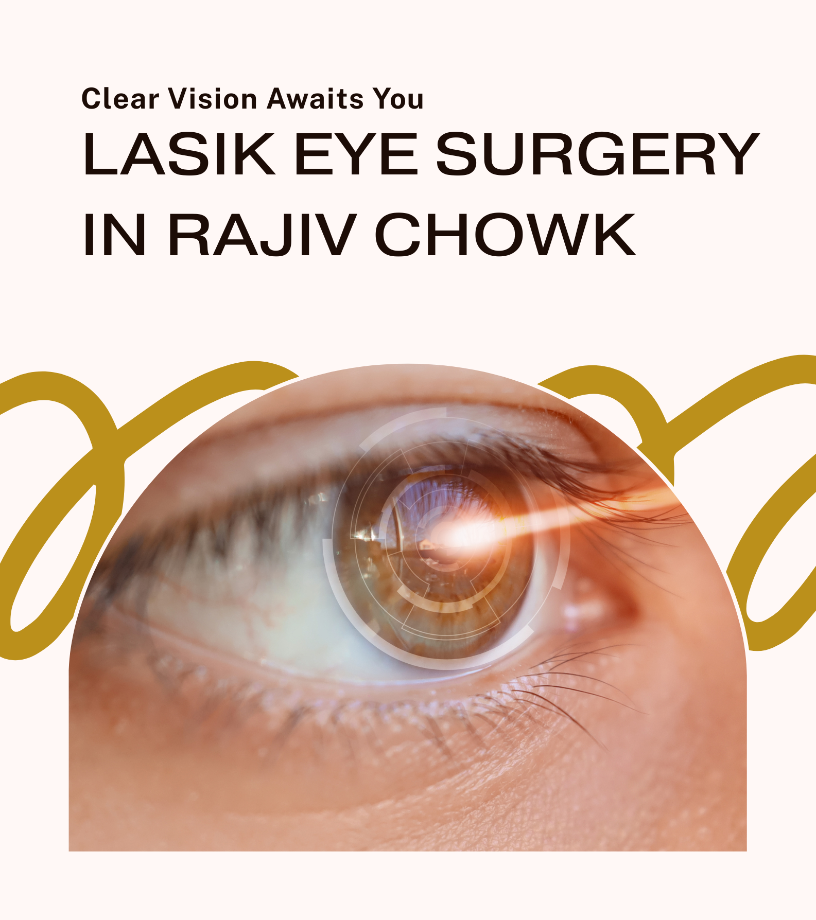 Top-Rated LASIK Eye Surgery in Rajiv Chowk | Laser Vision